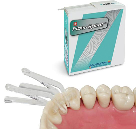 Fiber-Splint Polydentia